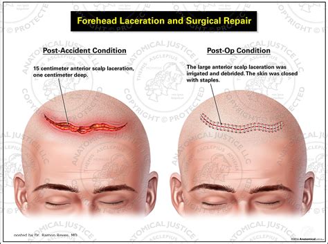 Ems Solutions International By Drramonreyesmd Marca Registrada Scalp