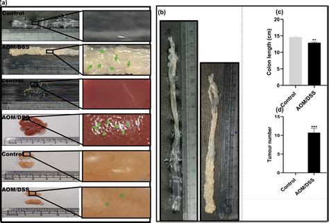 Effect Of Aom Dss On A Representative Photomicrographs Showing Colon Download Scientific