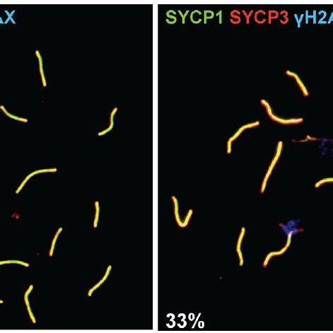 Sex Body Formation In The Prdm PWD F Hybrid Male Surface Spread Download Scientific