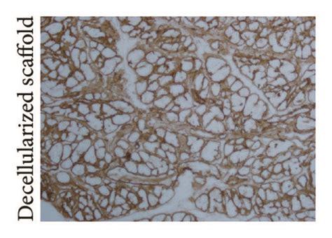 Analyzation Of Ecm Components A B Hande Staining Of The Normal Download Scientific Diagram