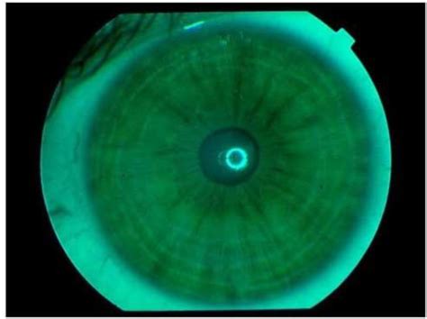 green component of image download scientific diagram