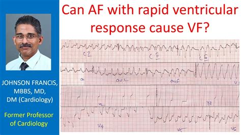 Atrial Fibrillation With Rapid Ventricular Response