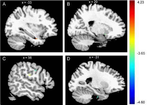 Artificial Intelligence In Medical