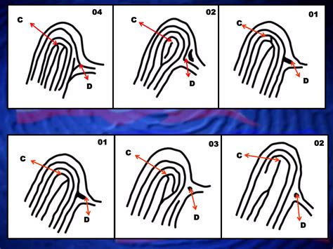Fingerprint Classification Loop Patterns Pptx