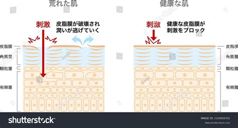 36 Imágenes De Sebaceous Membrane Imágenes Fotos Y Vectores De Stock