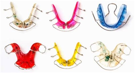 Ortodontie Ce Tipuri De Aparate Dentare Exista Pentru Copii