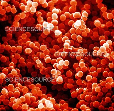 Staphylococcus Aureus Sem Stock Image Science Source Images