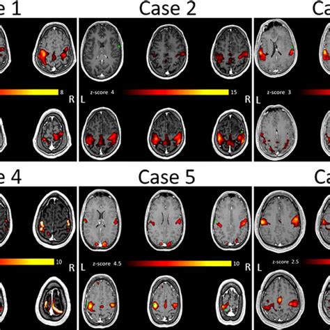 Flowchart Of The Rs Fmri Data Analysis Pipeline Implemented In