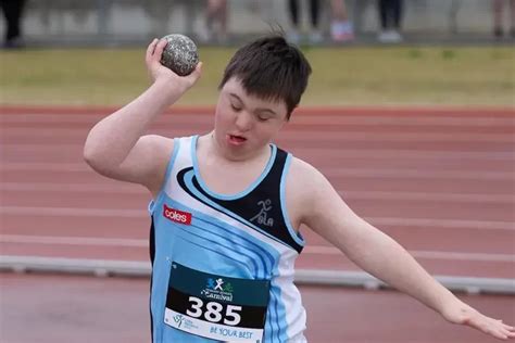 سندروم داون Down Syndrome چیست؟ علائم، علل، تشخیص و درمان سندرم داون