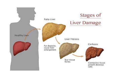 Ast Alt Levels In The Liver Definition Significance Tests 56 Off