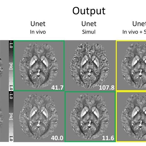 The Qsm Processing Pipeline Includes Phase Unwrapping Background Field Download Scientific