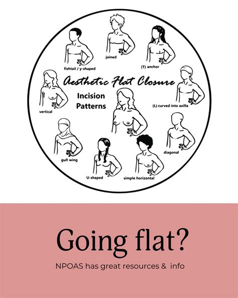 Breast If You Or A Loved One Is Considering Going Flat After Mastectomy You Should Know That