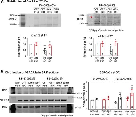 Sucrose Gradient Fractionation Of Cardiac Microsomes Download Scientific Diagram
