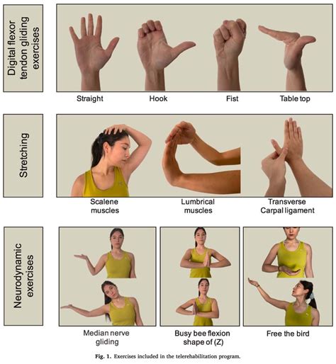 Pain Education Exercise For Carpal Tunnel Syndrome Research