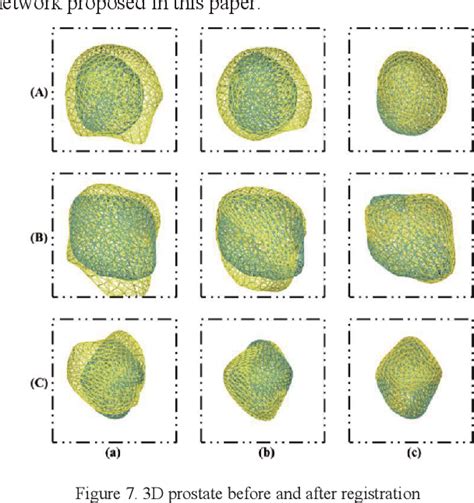 Figure 7 From Prostate Mritrus Image Registration Algorithm Based On Weak Supervision