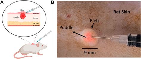 Intradermal Route