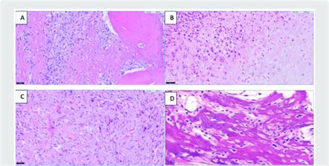 Optical Microscopy Showing The Identification Of The Cellular Osteoid Download Scientific