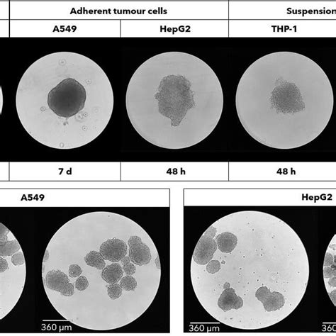 Spheroids Of Different Cell Lines Formed At Different Time Points After Download Scientific