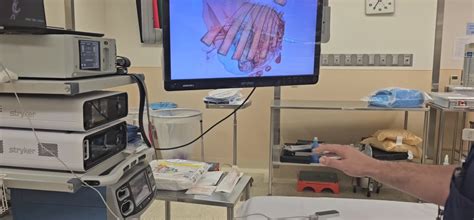 Created A Reconstruction Of A Cta Using 3d Slicer I Can Manipulate The Images Without Breaking