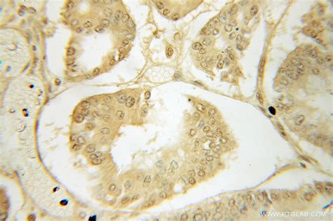 Tpk1 Fusion Protein Ag1404 Proteintech