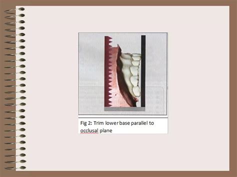 Ortho Study Model Analysis Ppt