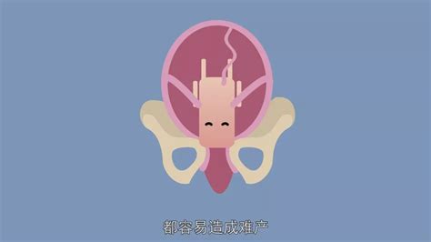 老人总说臀部丰满的女人最好生养，老理还是伪科学？ 搜狐大视野 搜狐新闻