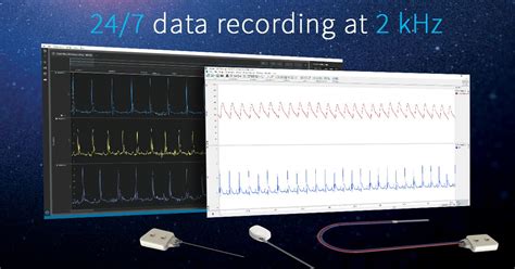 For The Wireless Recording Of A Variety Of Biological Signals In Small