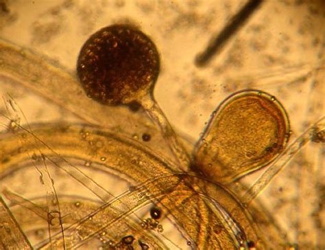 Organismal Diversity Lab Practical Fungi Flashcards Quizlet