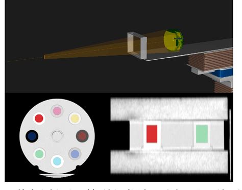 Figure 1 From The Influence Of Dual Energy Computed Tomography Image