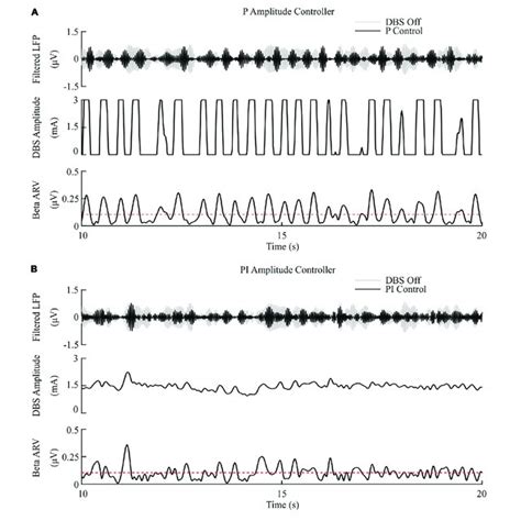 effect of open loop dbs parameters on stn lfp beta band power a