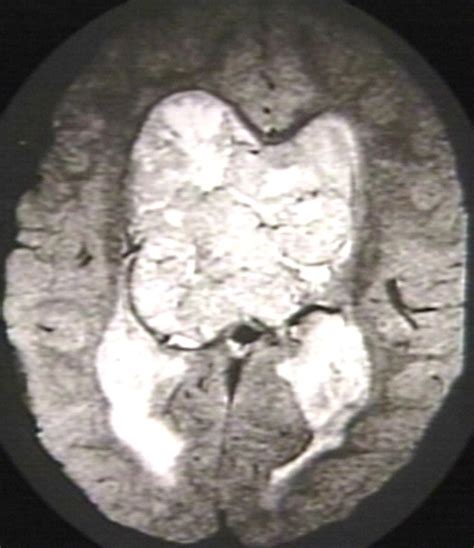 00229868 Peir Digital Library