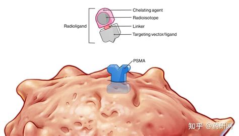 前列腺癌标志物：psma 知乎