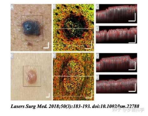 活体微循环三维血管成像解决方案 知乎