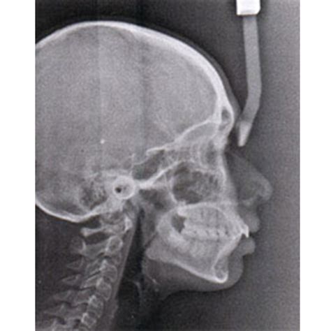 Beli Vision Opg System Dengan Harga Terbaik