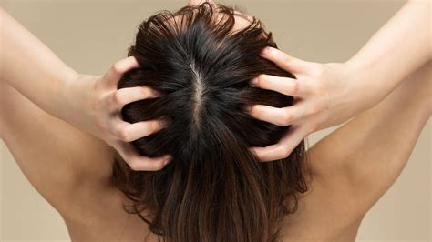 Scalp Build Up Causes And Ways To Deal With Sebum Healthshots
