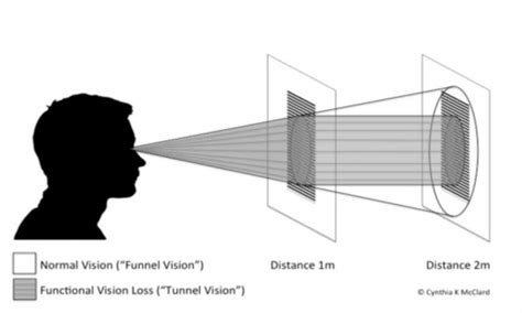 Functional Visual Loss Eyewiki