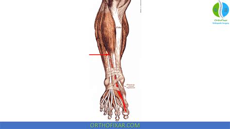Extensor Hallucis Longus Orthofixar
