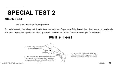 Case Presentation Tennis Elbow With Detailed Assessment Pptx