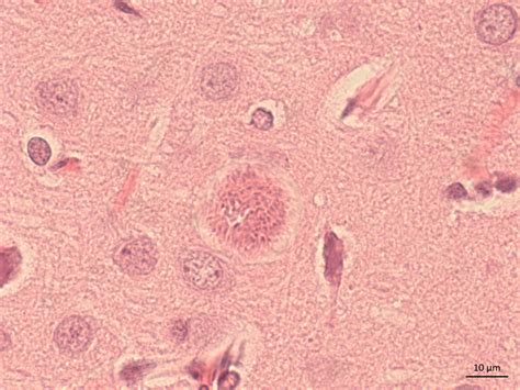 Companion Animal Parasite Council Toxoplasma Gondii