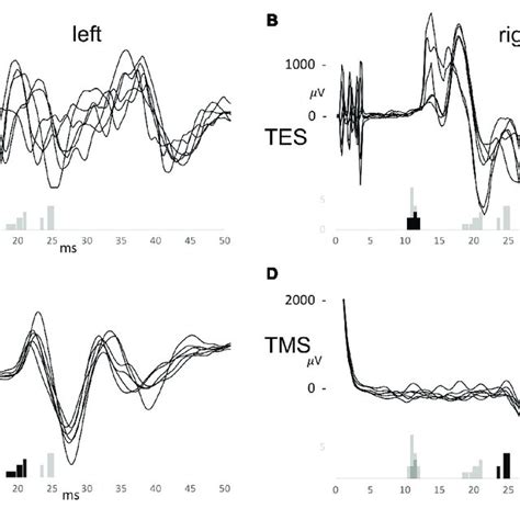 Overview Of Mep Latency Differences Ml El Of Tms And Tes After