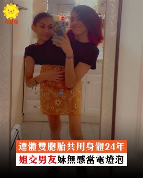 Teepr 亮新聞 【連體雙胞胎共用身體24年 姐交男友「妹無感當電燈泡」】