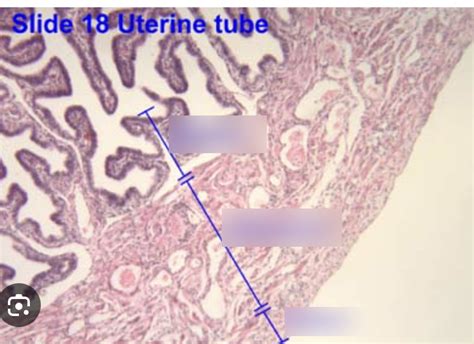 Uterine Wall Histology Diagram Quizlet