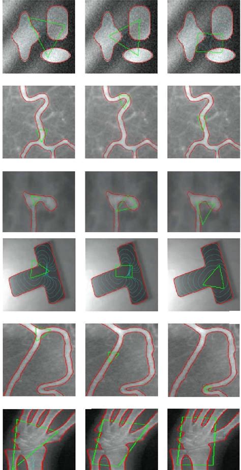 Figure 5 From An Active Contour Model Based On Local Pre Piecewise Fitting Bias Corrections For