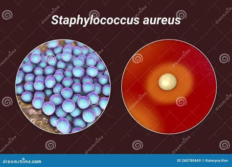 Bacteria Staphylococcus Aureus Stock Illustration