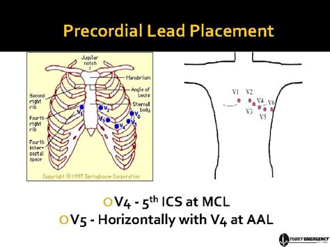 Almost Everything You Wanted To Know About Ecgs