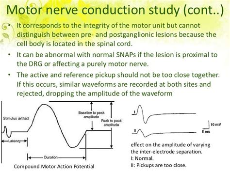 Nerve Conduction Study