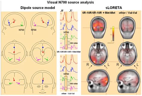Left 4 Dipole Source Model Fitted On The Early Cnv Time Interval By