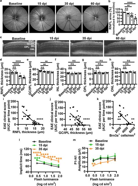 Retinal Nerve Fiber And Ganglion Cellinner Plexiform Layer Thicknesses