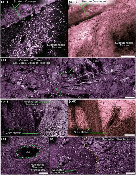 Total Absorption Second Generation Photoacoustic Remote Sensing Download Scientific Diagram