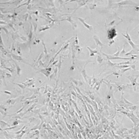 Morphology Transformation During Hipsc Msc Induction A Download